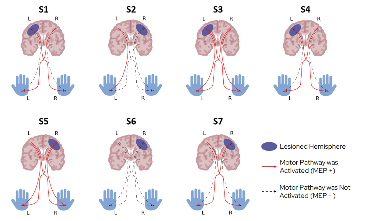 Bernadette Gillick, PhD, MSPT, PT – Slide of the Week – Waisman Center ...