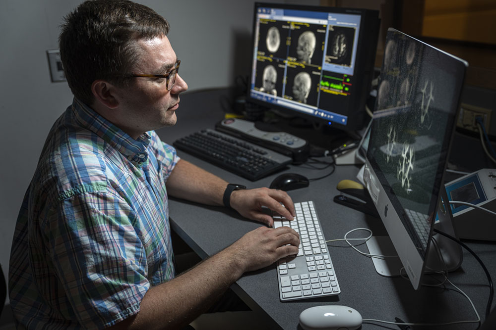Study Reveals Differences in Brain Structure for Older Autistic Adults – Waisman Center – UW–Madison